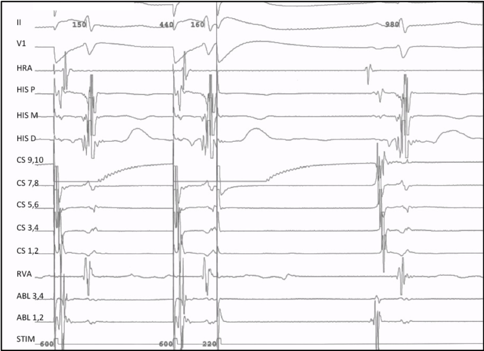 SVT Case Study - EP Essentials