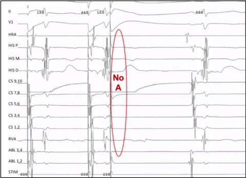 SVT Case Study - EP Essentials