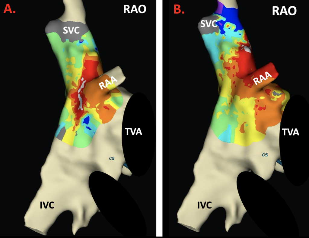 SVT Case Study - EP Essentials