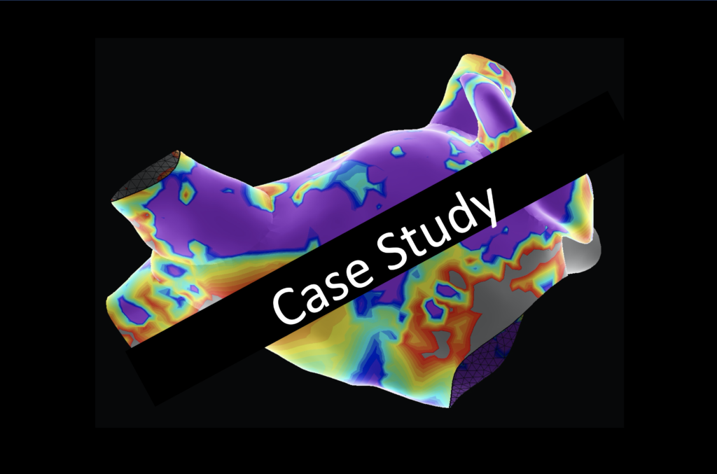 SVT Case Study - EP Essentials
