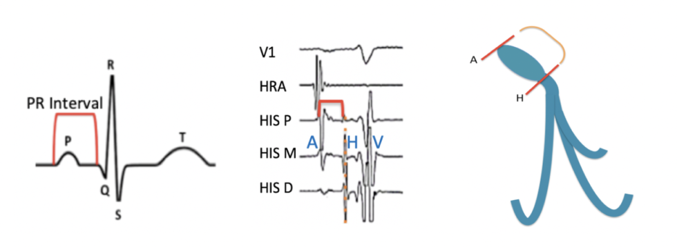 AV Junction - What's Your Function? - EP Essentials