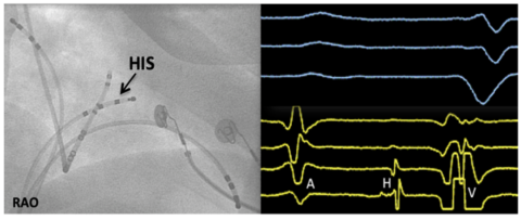 AV Junction - What's Your Function? - EP Essentials