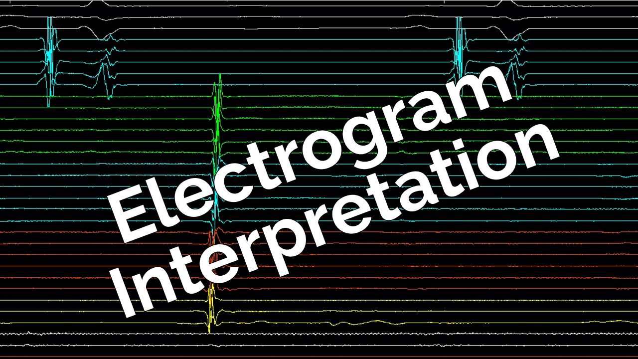 Electrogram Interpretation 15 Ep Essentials