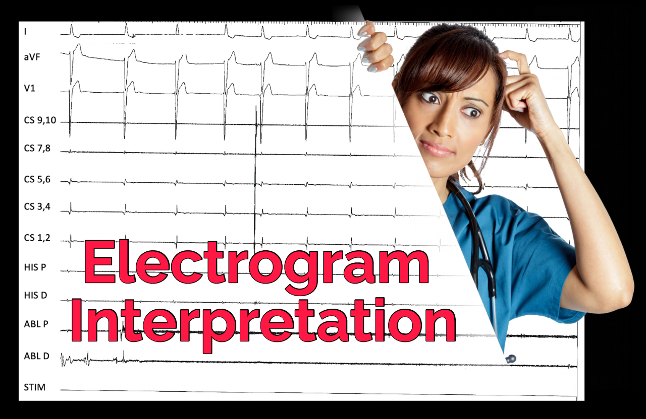 Blog - EP Essentials