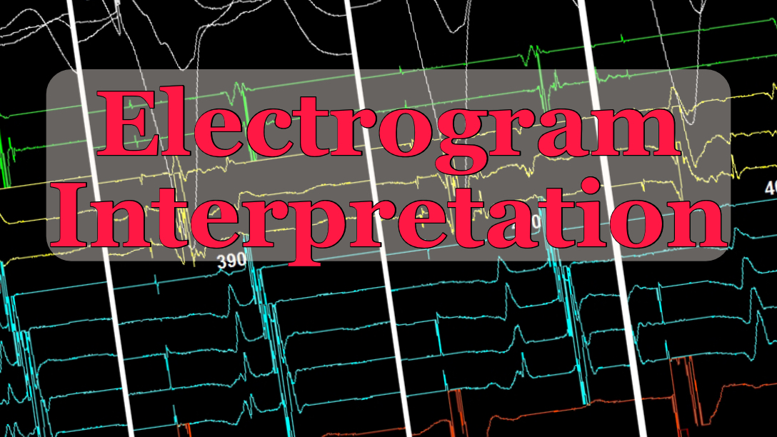 Blog - EP Essentials