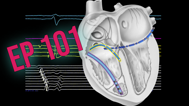 EP 101 - Catheter Placement - EP Essentials