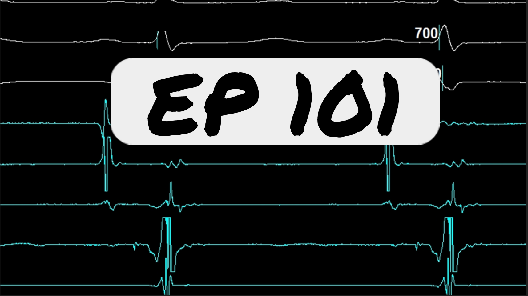 EP 101 - Signals & Catheter Positioning - EP Essentials