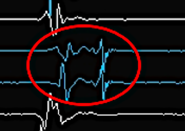 The What, Where & Why of Double Potentials - EP Essentials