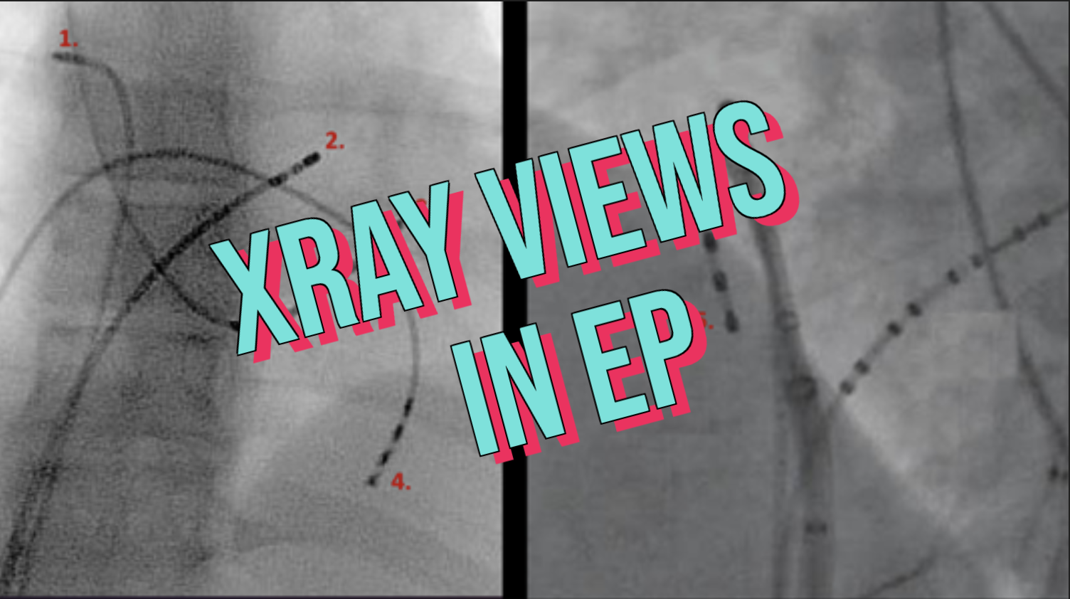 XRay Views in EP - EP Essentials