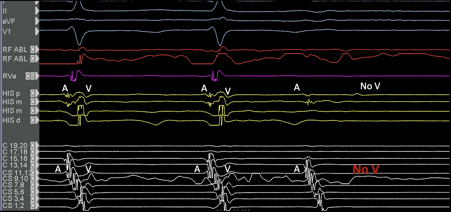 Let's Burn! - EP Essentials