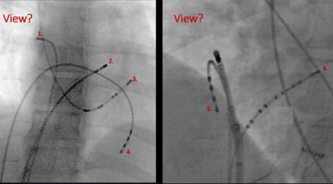 XRay Views in EP - EP Essentials
