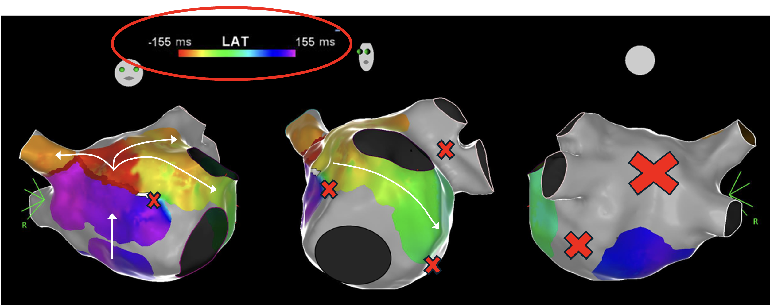 Atypical AFL Map Interpretation - EP Essentials