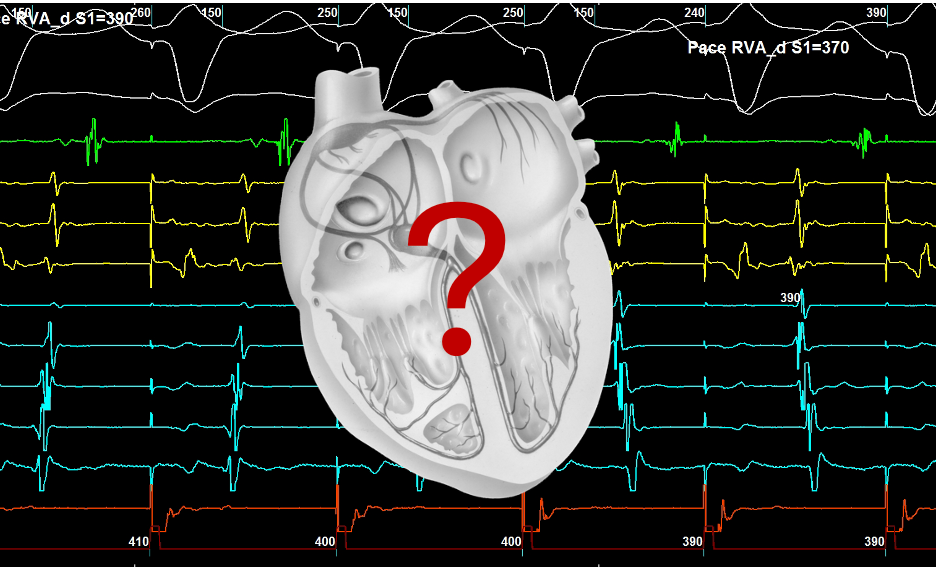 EGM Interpretation - 25 - EP Essentials